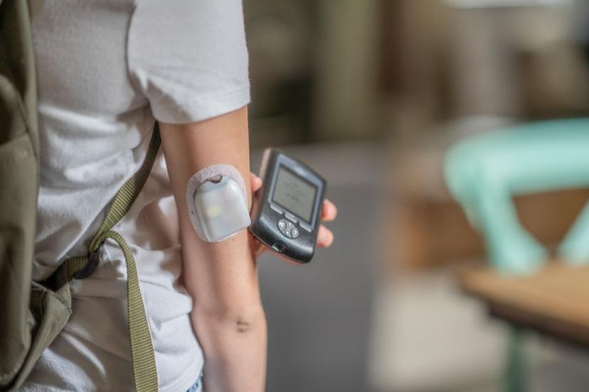 Insulin Pump ICD-10 Codes: How to Document Pump Status, Presence ...